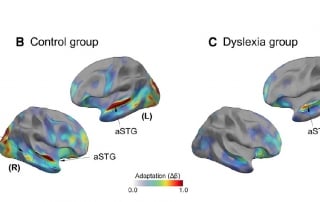 rote memory Archives | Dyslexia | Dyslexic Advantage
